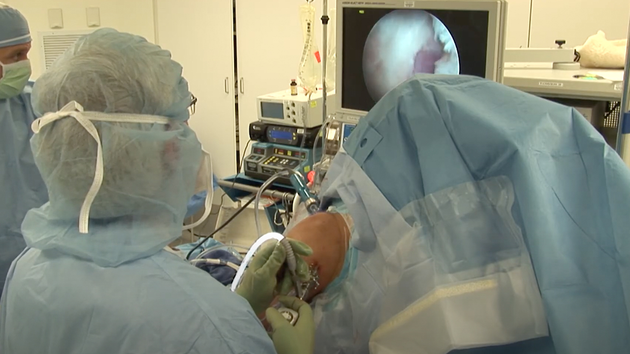 Orthopedic Surgery Video Gallery | Paul Meli Orthopedic Surgeon